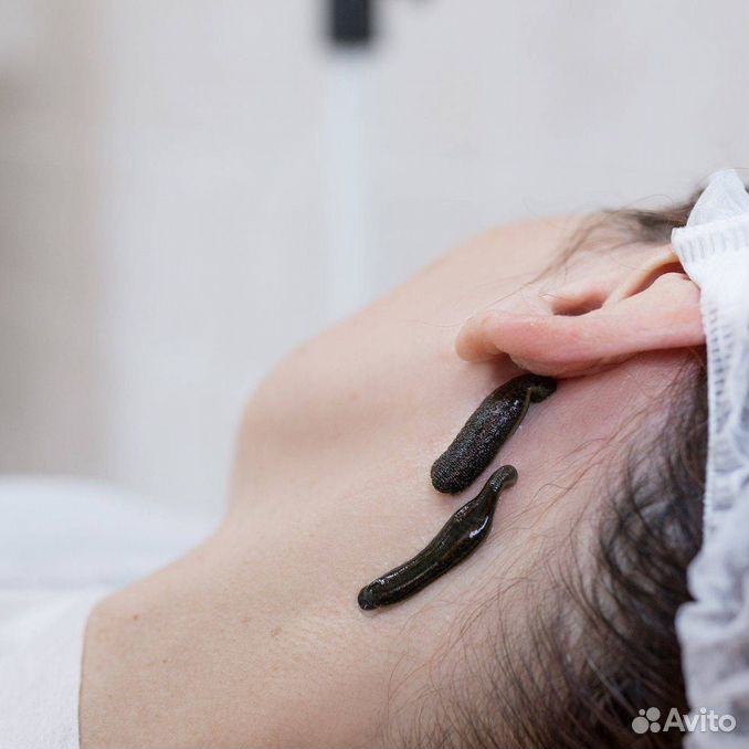 Пиявка лечебная