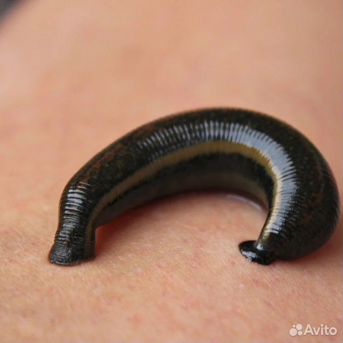 Пиявки медицинские